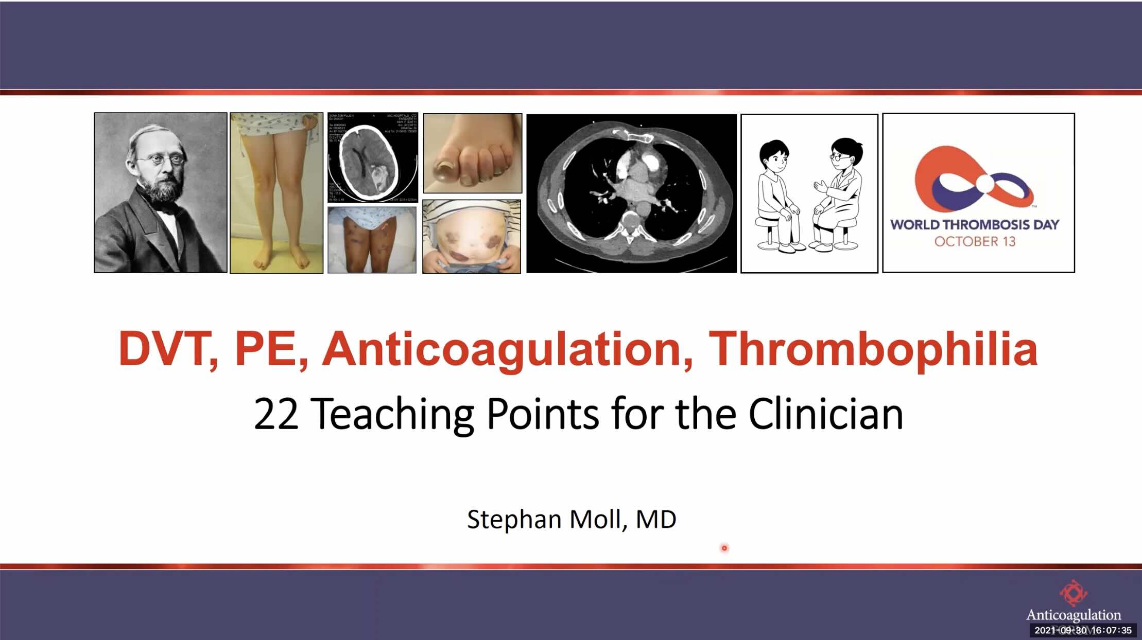 Anticoagulation Forum
